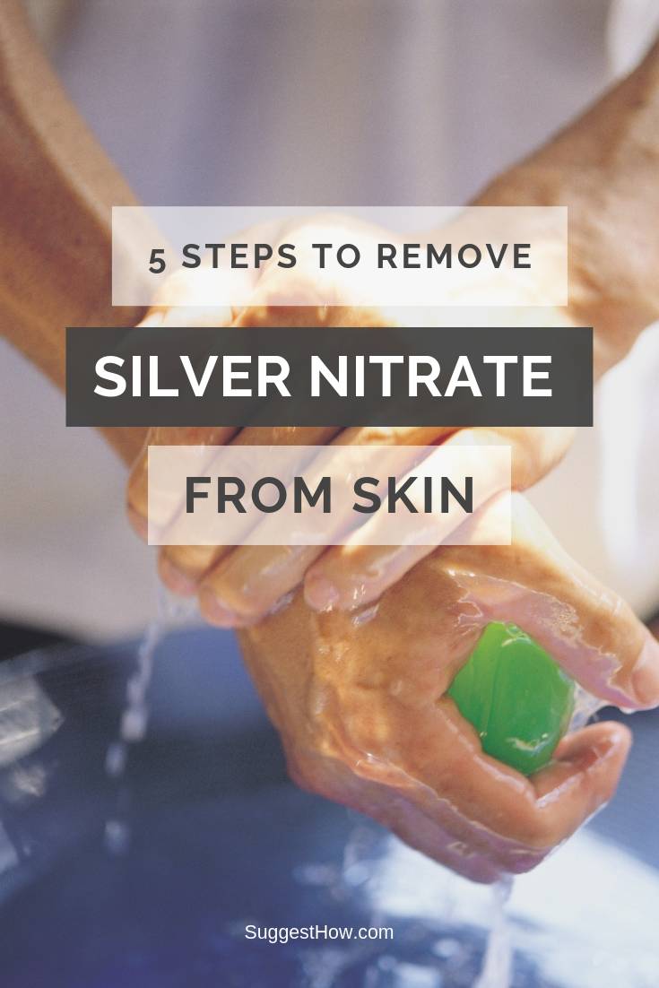 How To Remove Silver Nitrate Stains On Skin